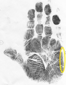 How depression shows up in hands – Hand Analysis Online