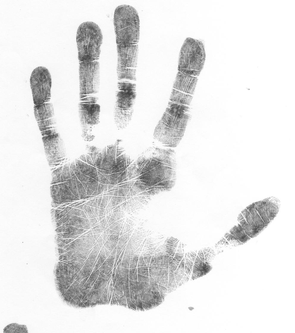 Next hand analysis class with Richard Unger Burnout. It’s in your hands ...