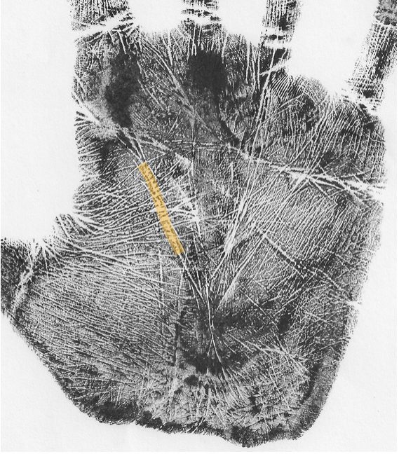 Breaks in the life line and breaks in the heart line – Hand Analysis Online